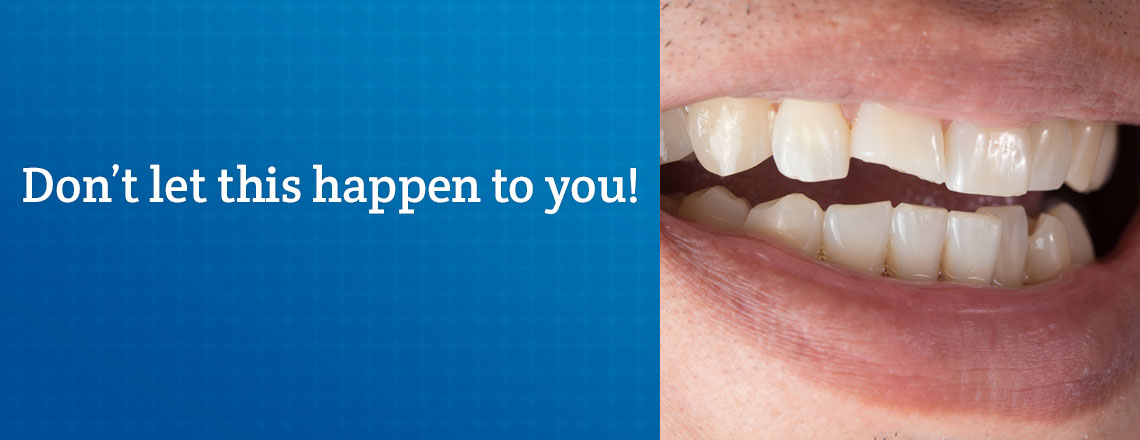 Sports-Related Tooth Injuries